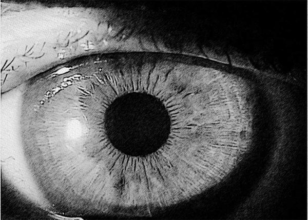 Keratoconjunctivitis Sicca – Retyne.com