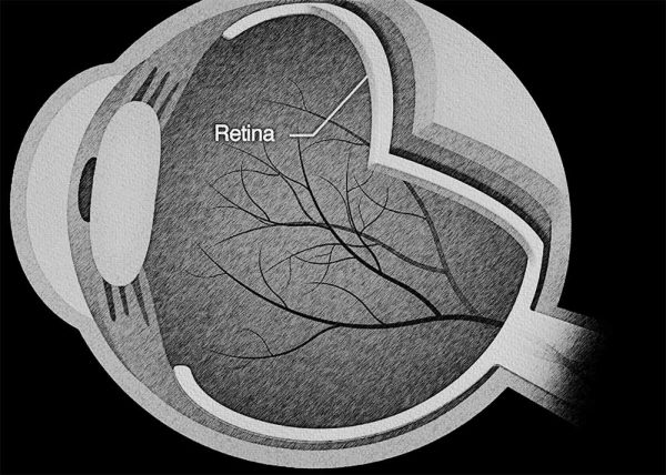 Retinal Disorders General – Retyne.com